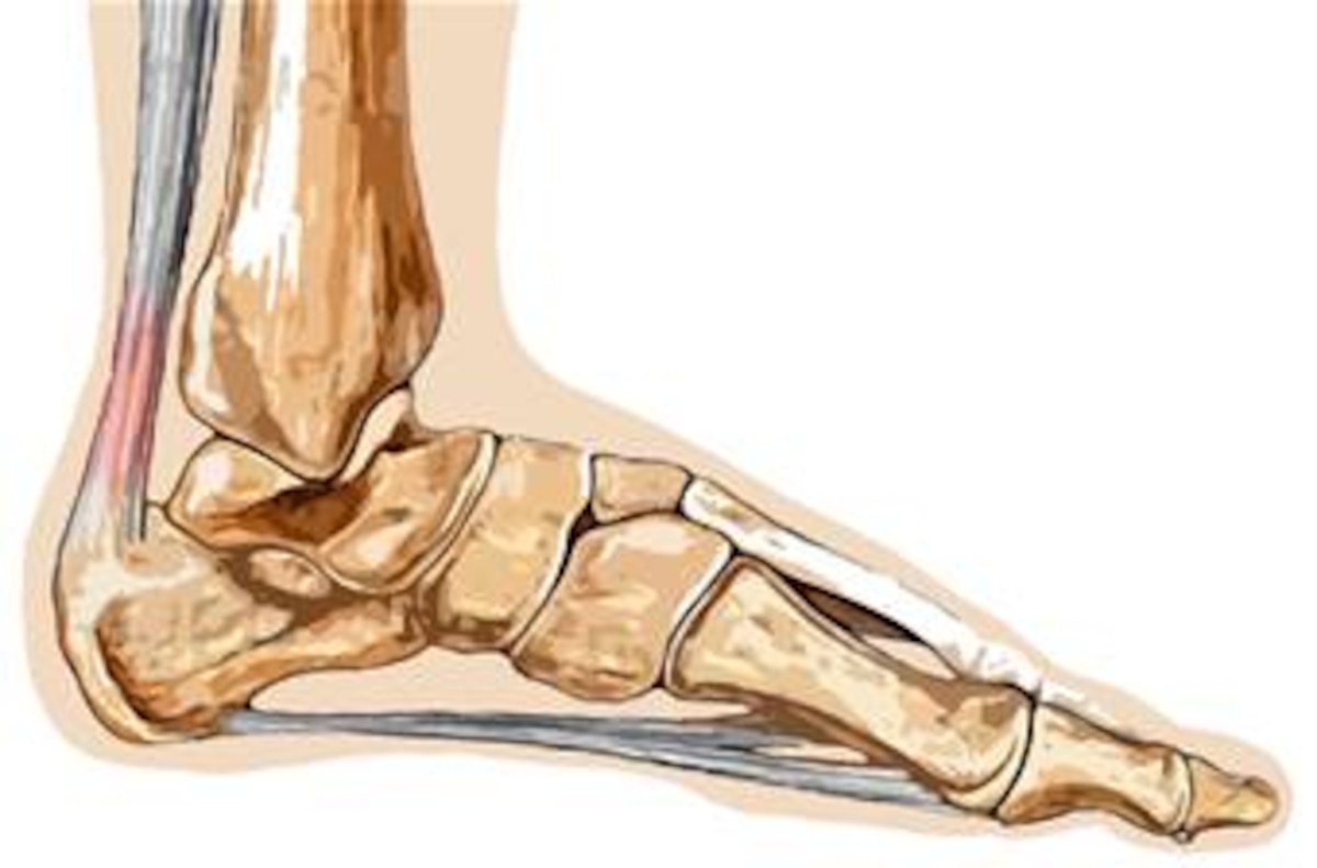 HER ACHILLES HEEL > Torch > Article Display