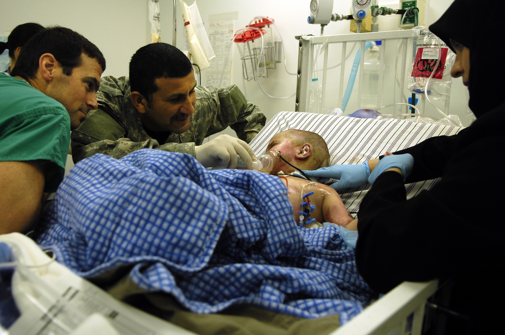 Little, but strong: burned Iraqi child overcomes odds > U.S. Air Forces ...