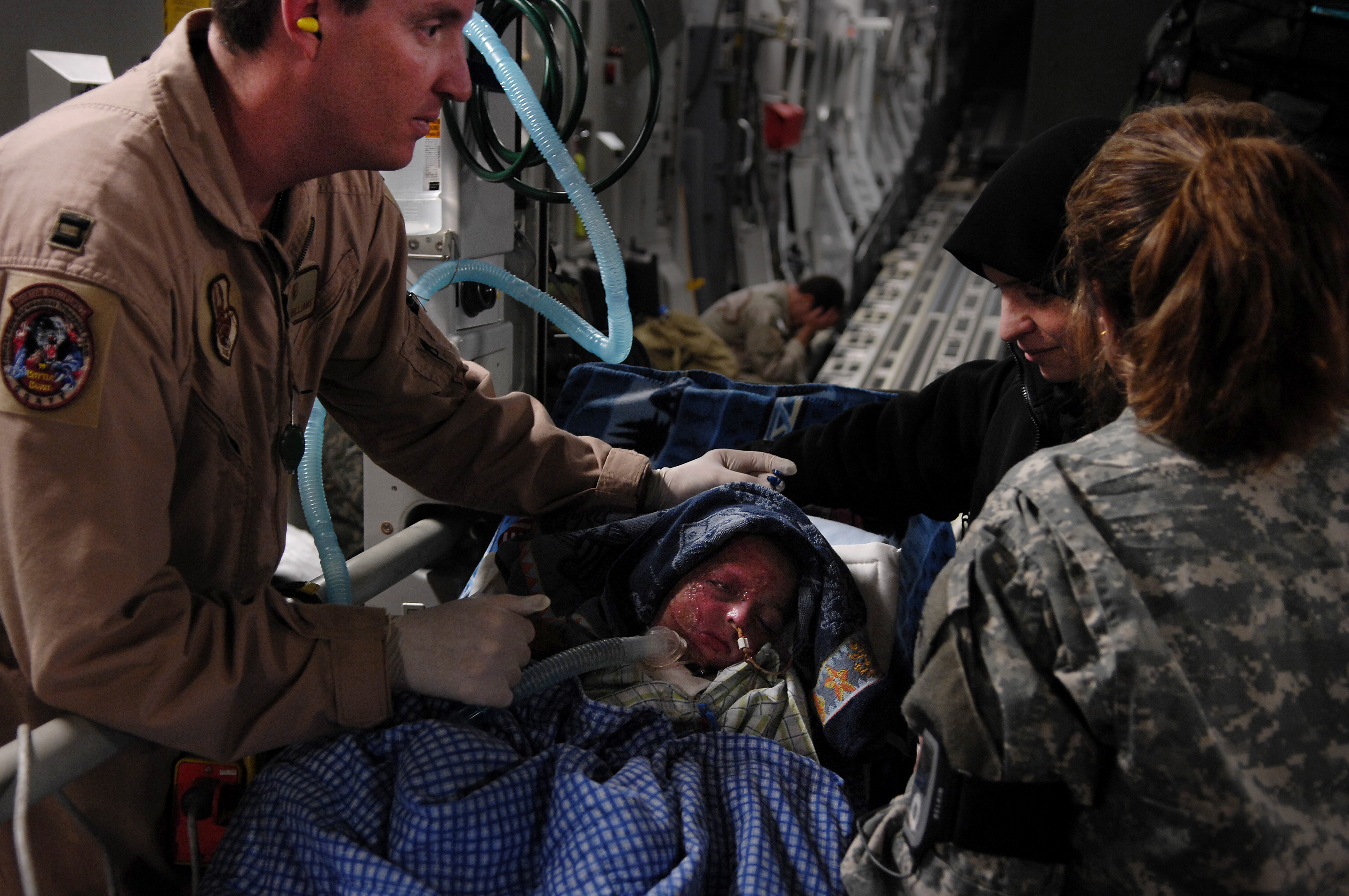 Iraqi burn victim transported to U.S.