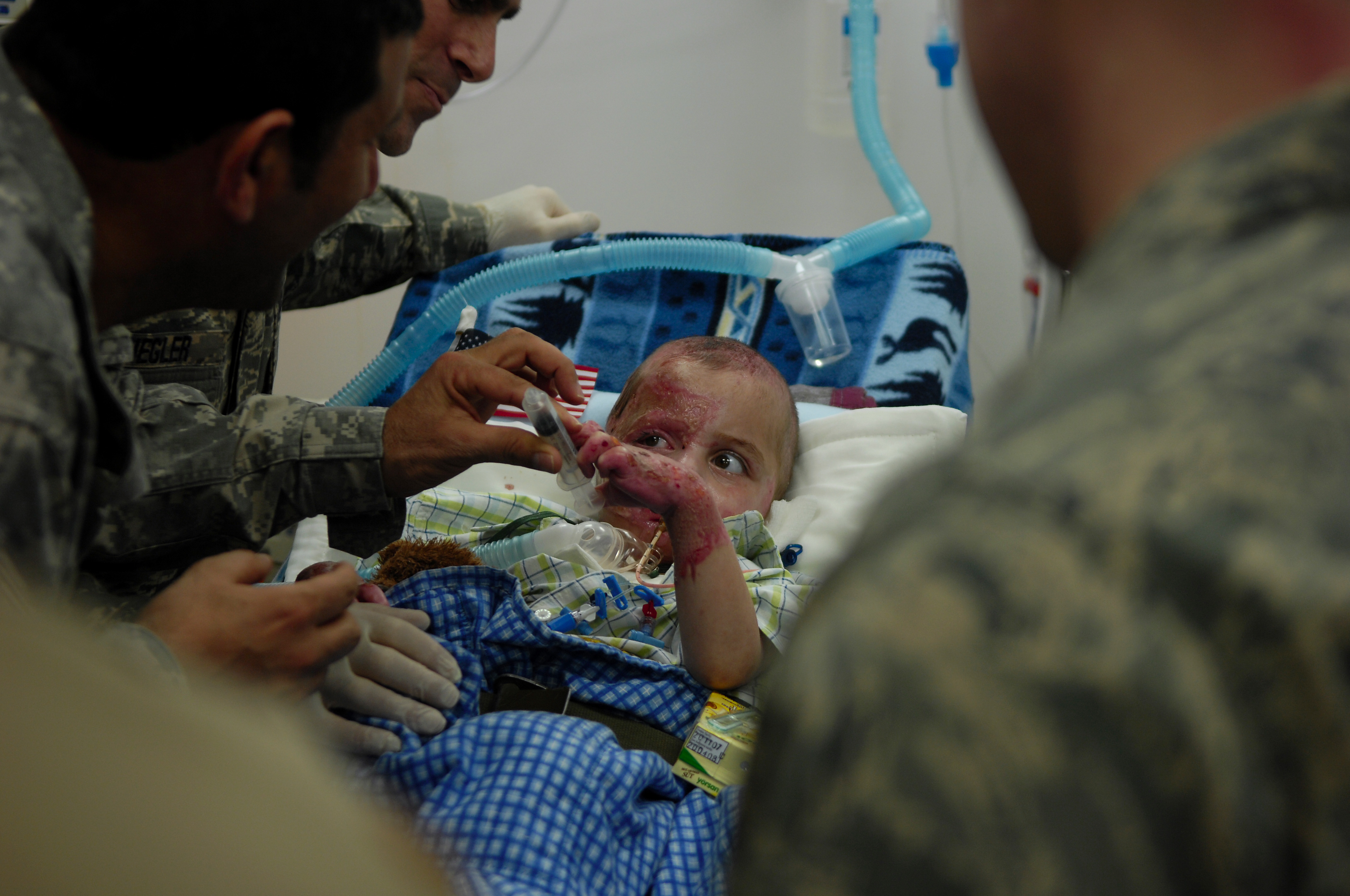 Iraqi burn victim transported to U.S.