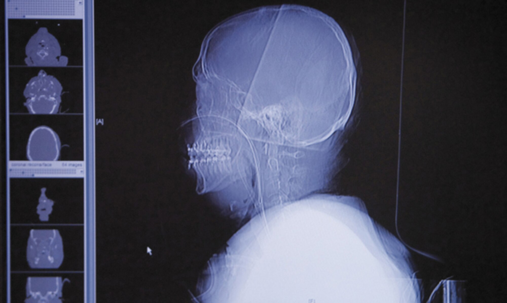 DOD, VA share records to benefit wounded warriors, veterans > 302nd ...