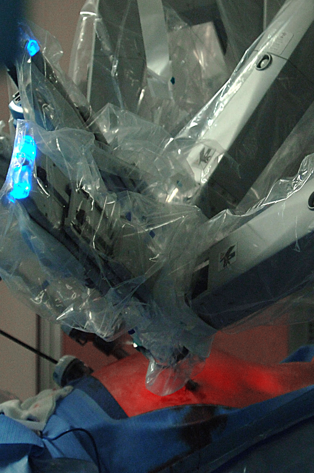 Doctor performs first robot-assisted surgery in the Air Force > Air ...