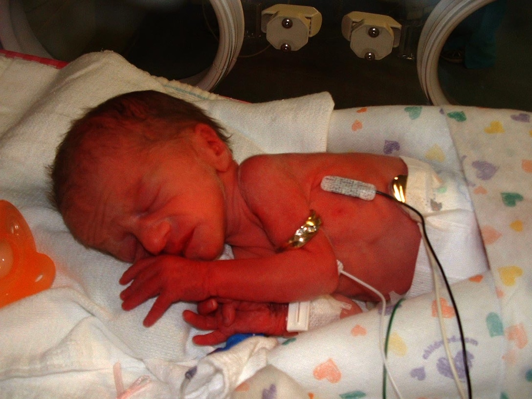 Cherry Point family uses story of survival to raise awareness about ...