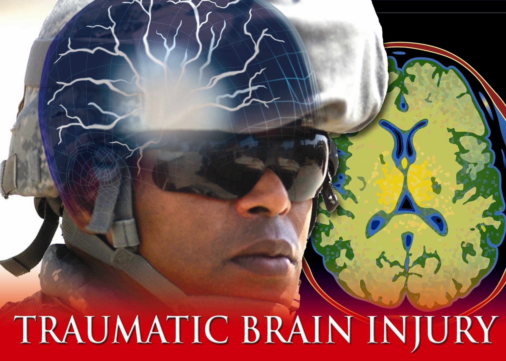Traumatic Brain Injury Military