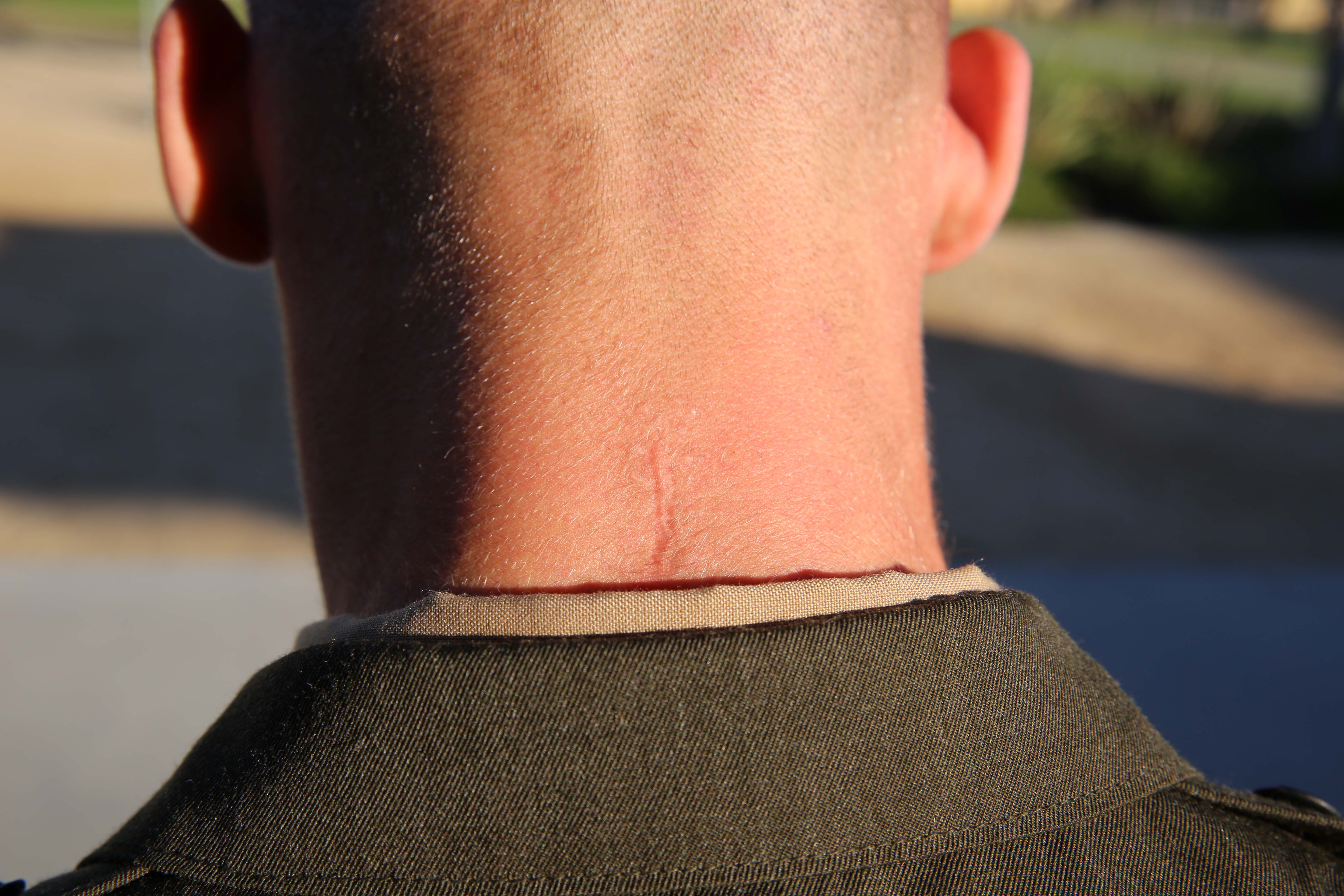 Boise, Idaho native overcomes tumor in spine to become a Marine