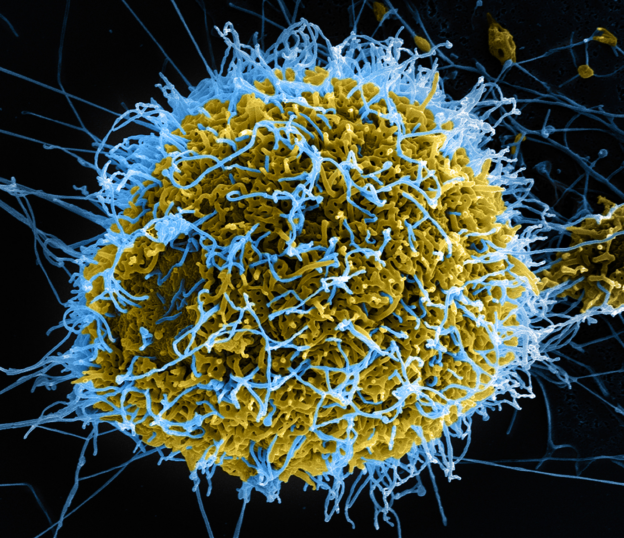 Virus Electron Micrograph