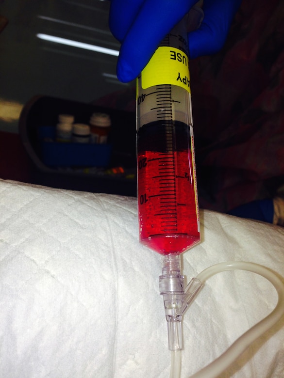 Airman wages war against breast cancer > Pacific Air Forces > Display