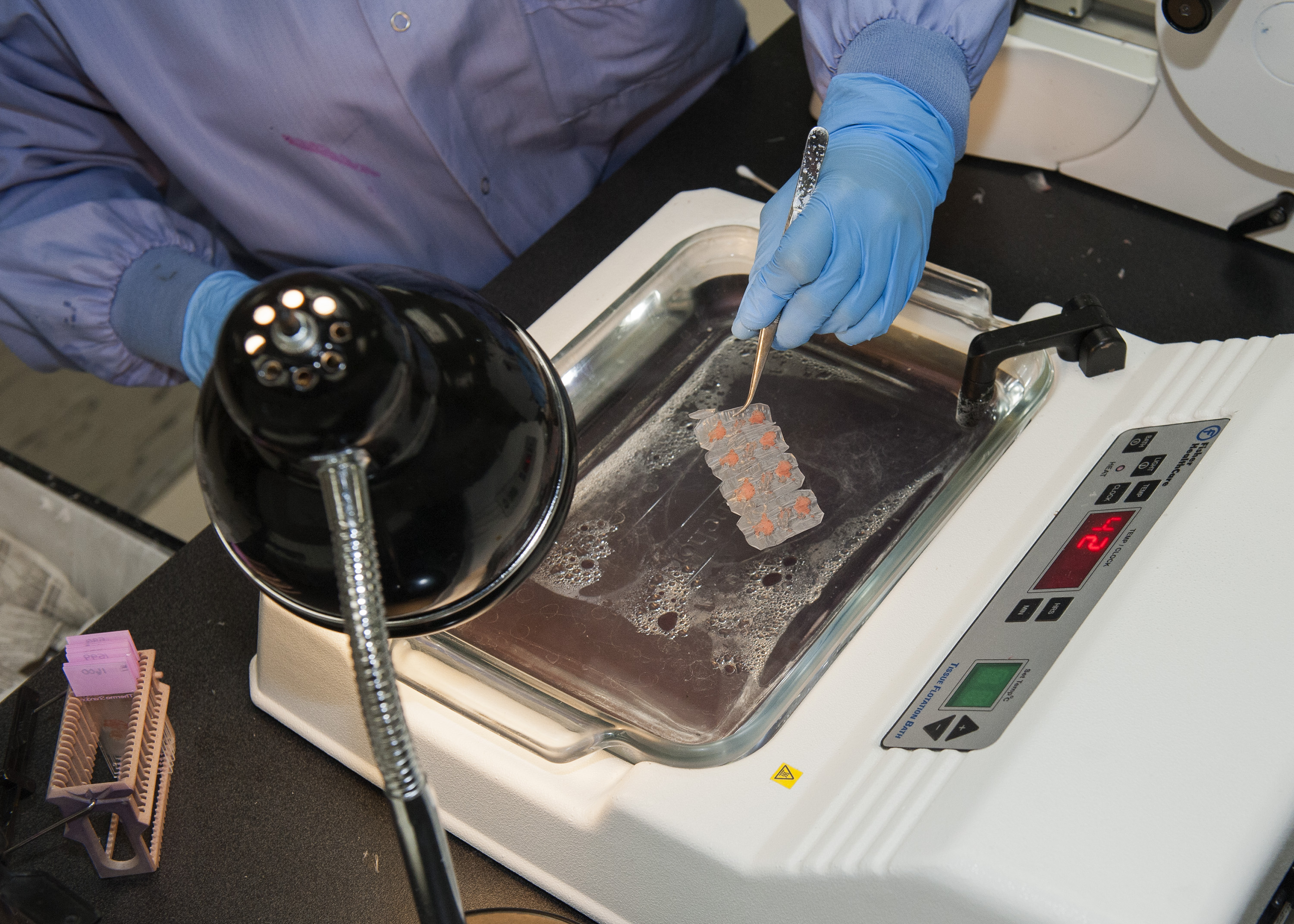 Pathology lab processes tissue