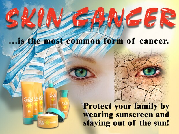 Sun’s UV rays pose long-term threat to people’s health