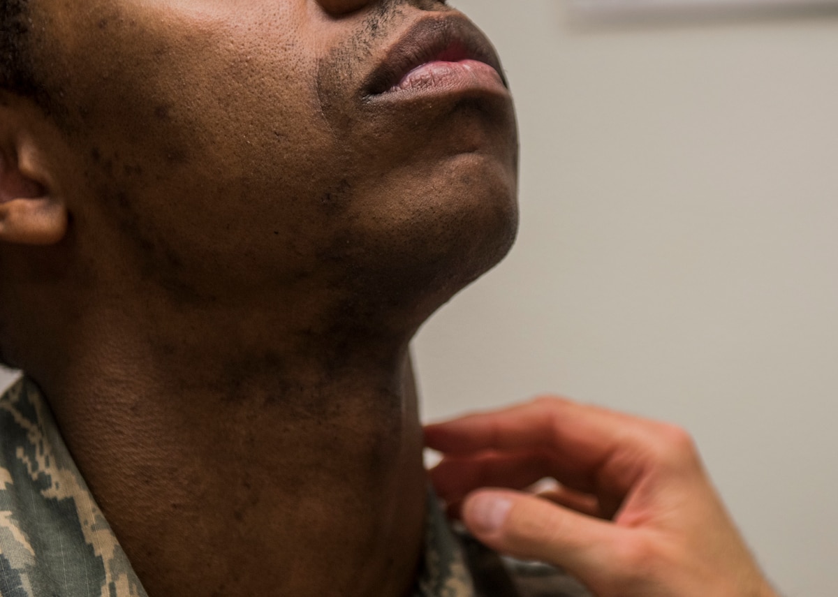 Air Force Surgeon General authorizes 5-year shaving waivers > Air Force ...