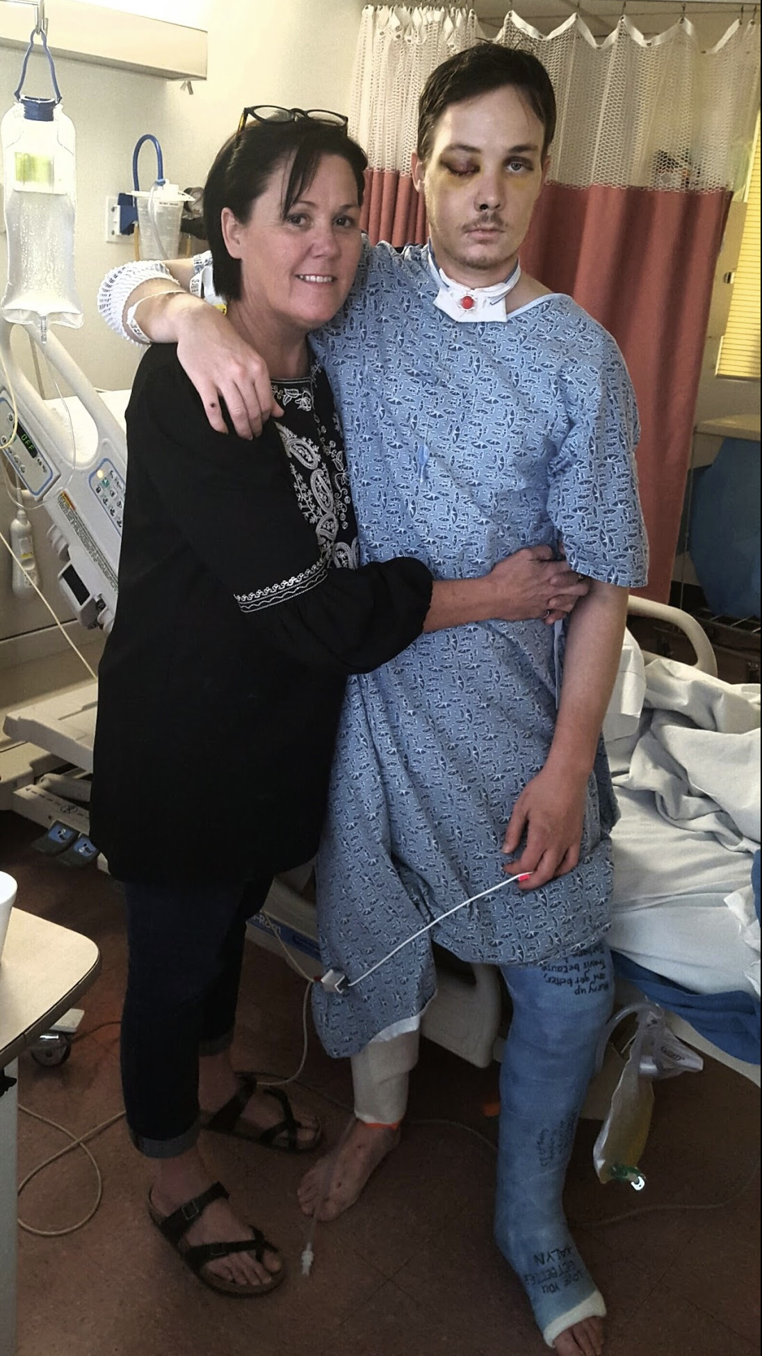 Fighting to fly: Creech Airman thrives after life-changing crash > Air ...