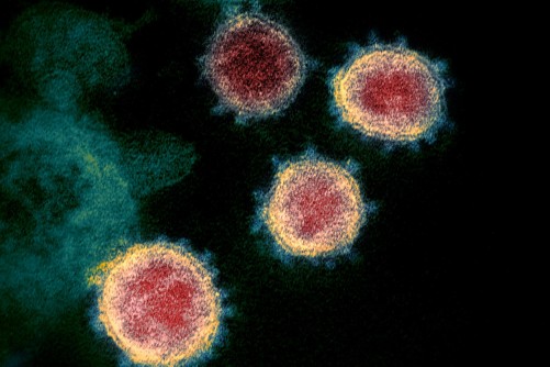 Llama Yields Antibodies That May Prove Effective Against COVID-19 ...