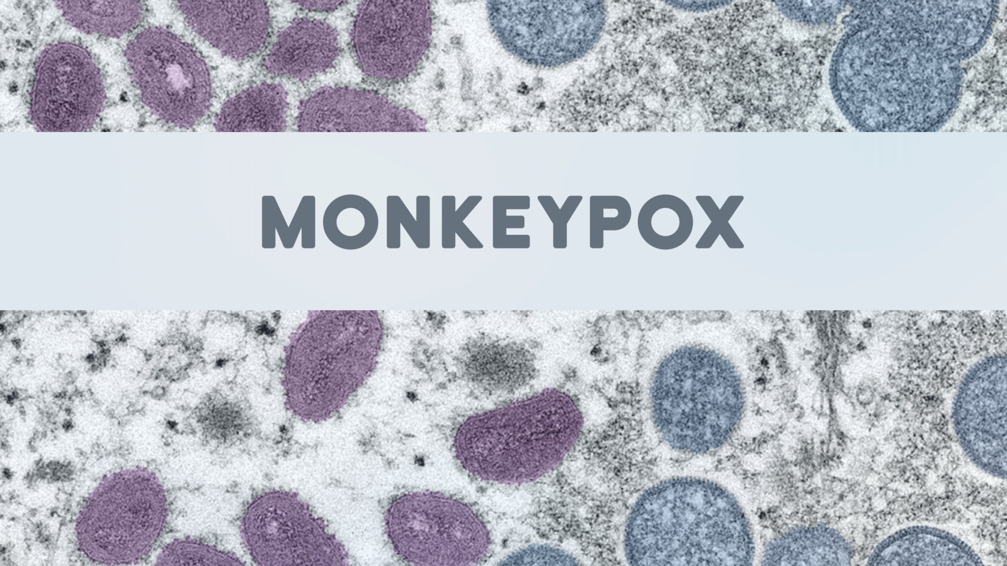 Monkeypox declared public health emergency: What Airmen, Guardians need ...