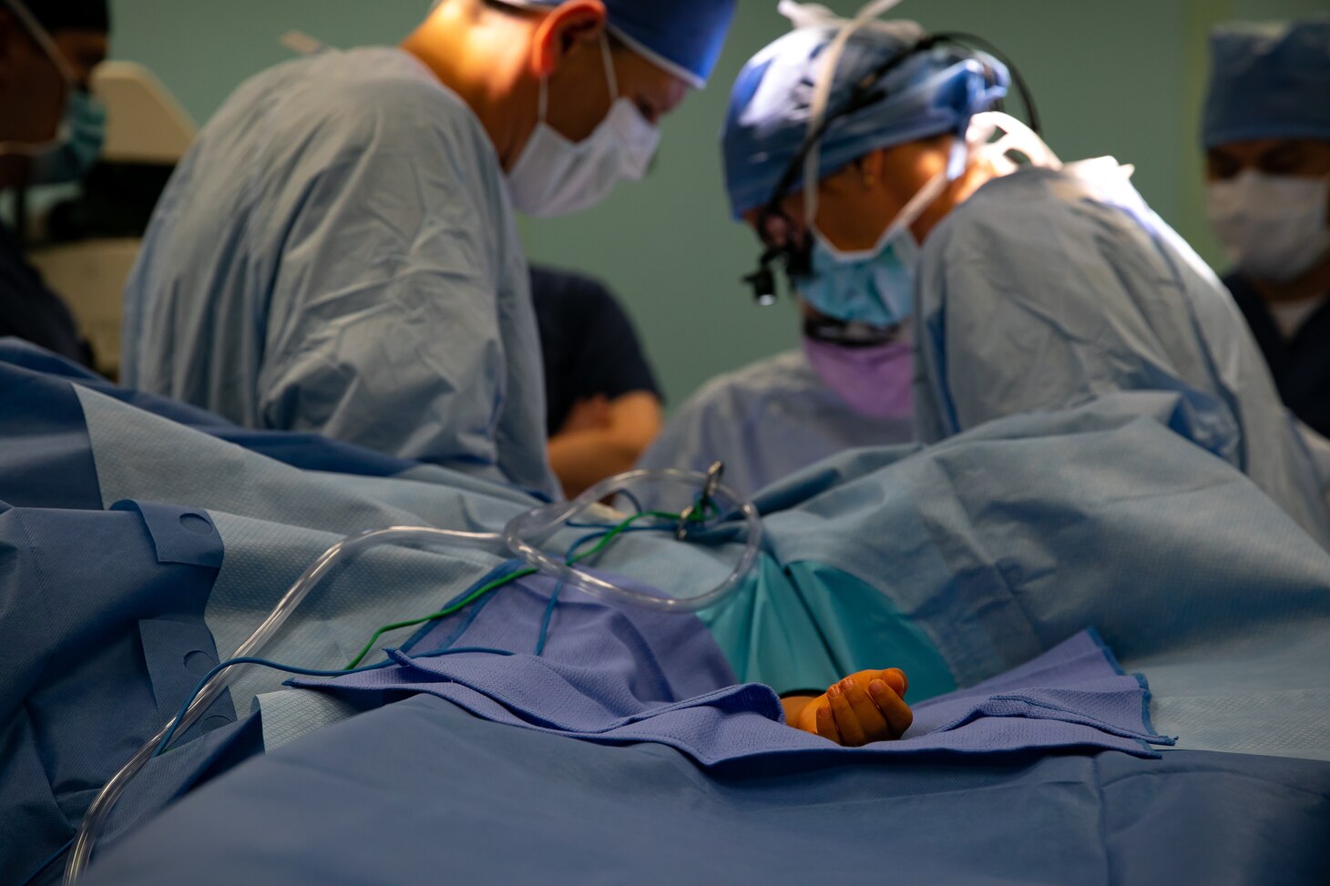 Separate and Whole: Thiago Palencia’s Life-Changing Surgery Aboard USNS ...