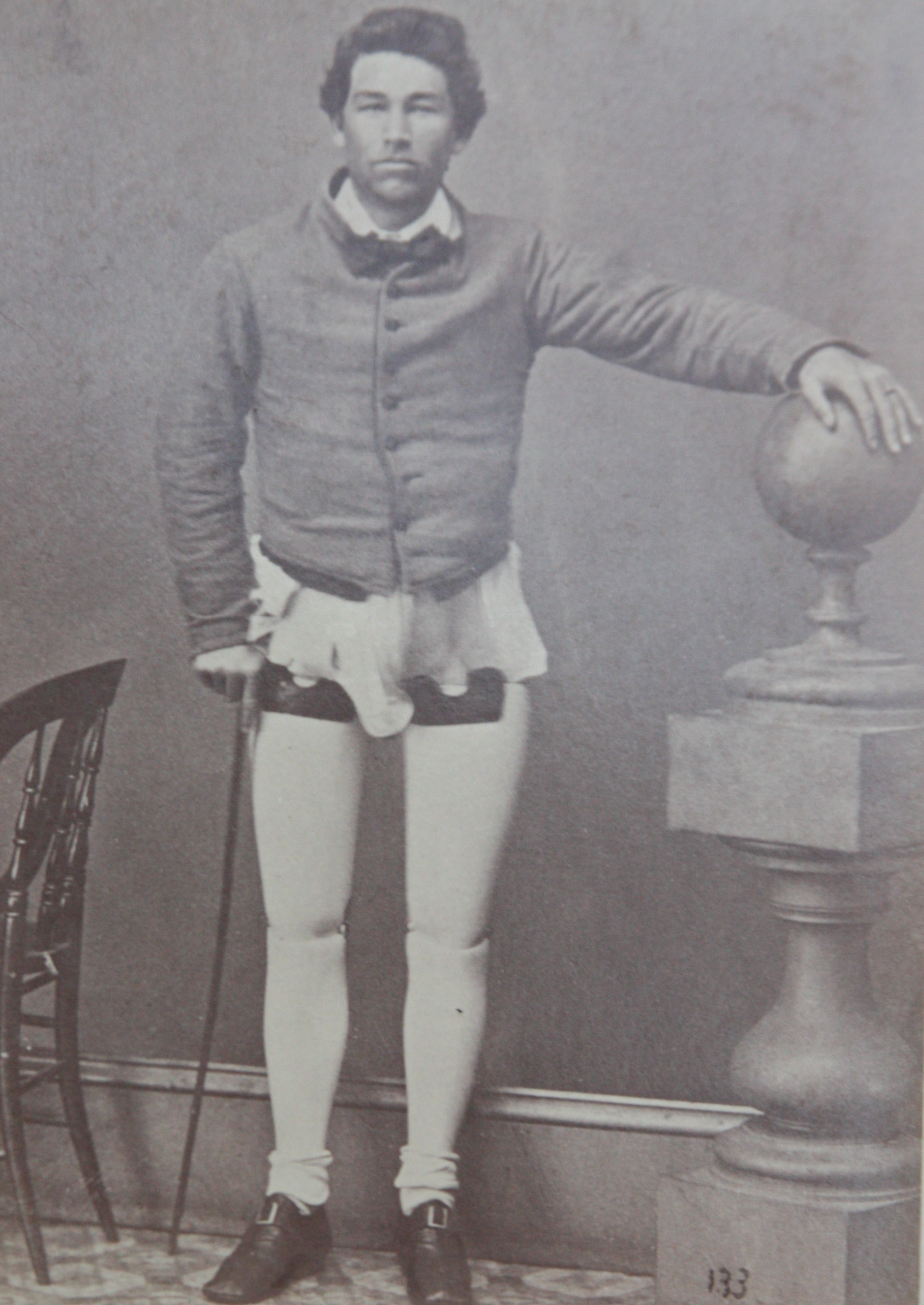 Advances in prostheses focus of medical museum’s Science Cafe > Navy ...