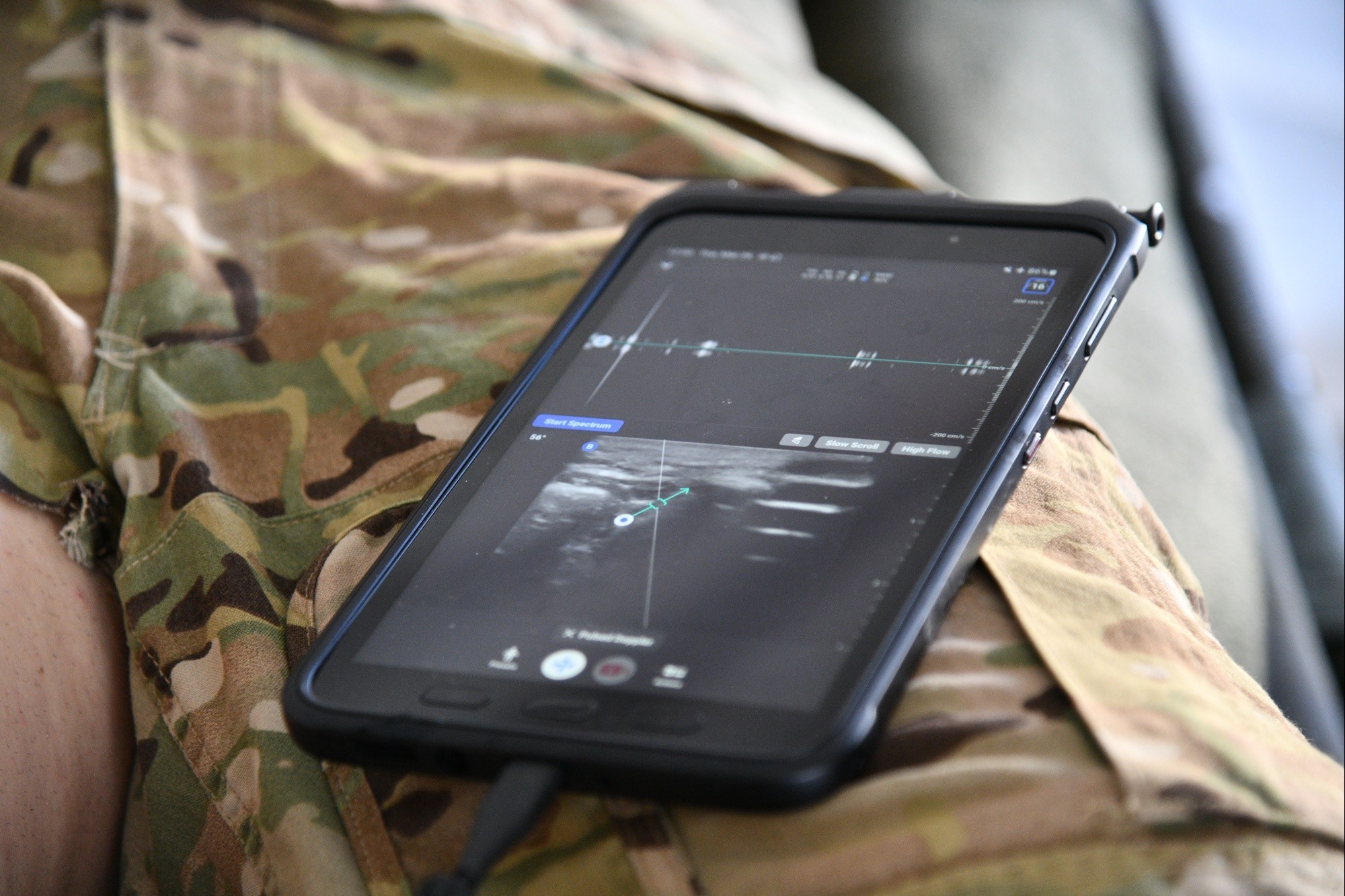 USAMTEAC tests new capability of ultrasound field portable for ...