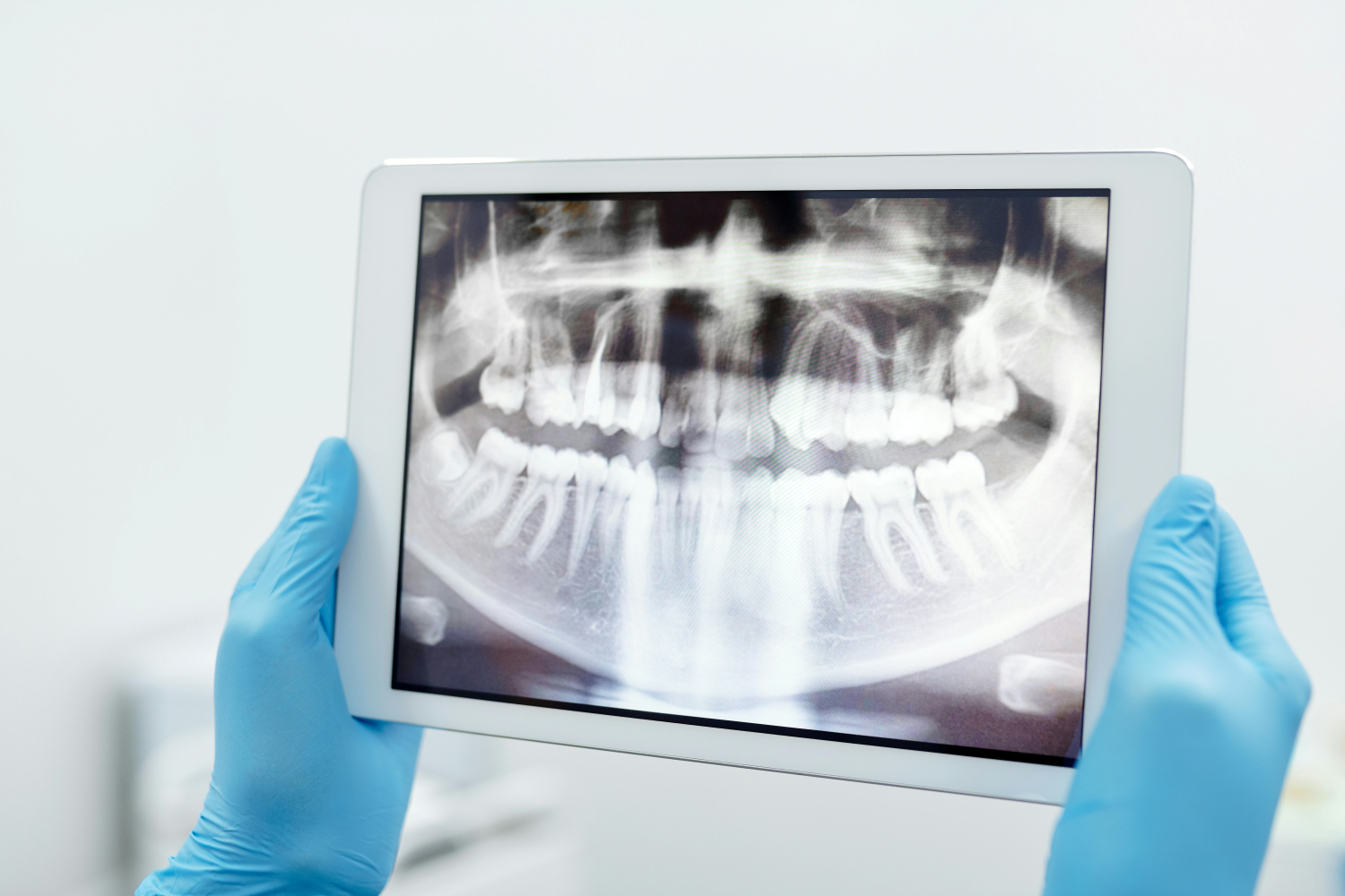 New TRICARE Dental Program Contract Brings Updates in March 2025 ...