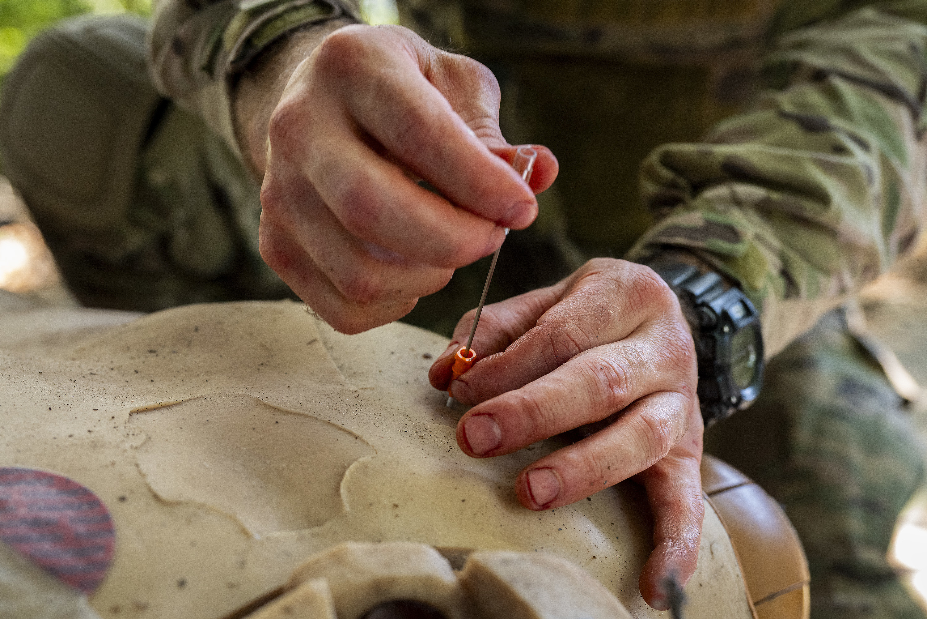 Battlefield medicine's bleeding edge > Torch > Article Display