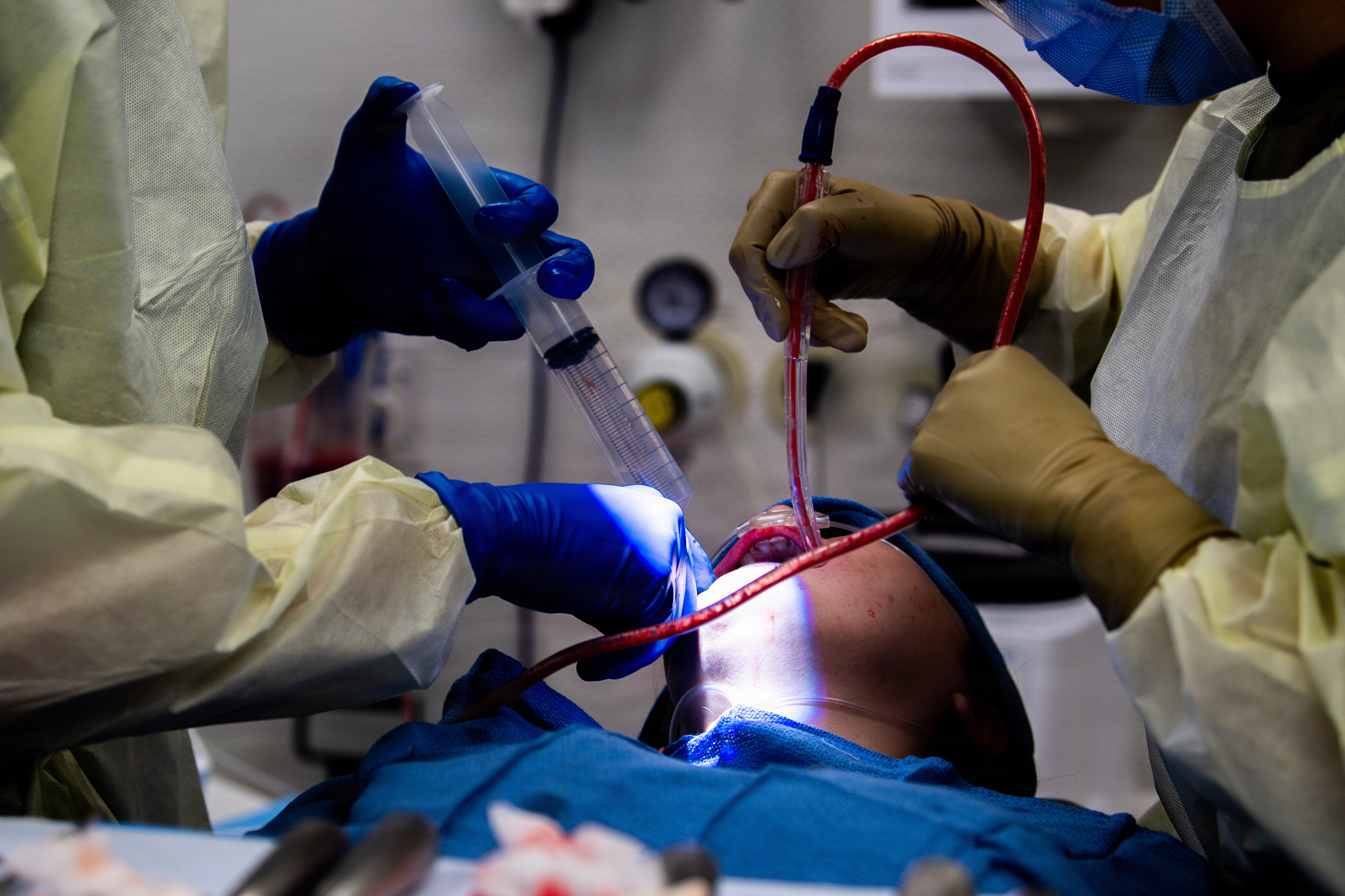 Tooth Extraction in Action: The 86th Dental Squadron > Ramstein Air ...